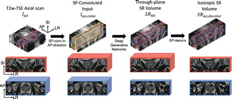 Figure 5 From High Resolution 3d Mri With Deep Generative Networks Via Novel Slice Profile