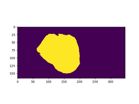 Dense Crf3d No Segm Produced For Single Modality Issue 2 HiLab