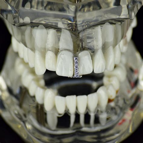 Silver Tone Gap Tooth Iced Cz Single Grillz