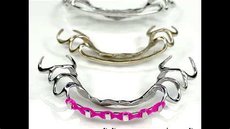 รีเทนเนอร์แบบโลหะสีเงิน สีทอง ตกไม่แตก ใส่กินอาหารได้ Youtube