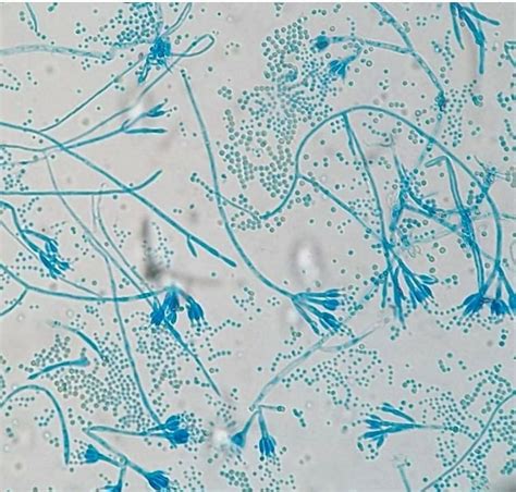 Microbiology 😍 Penicillium Spp Erika Terada 39 Comments