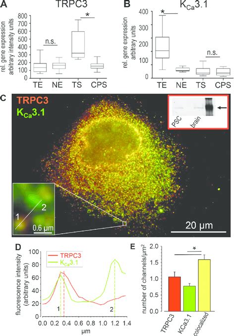 Data Mining Of Published Microarray Analysis From Microdissected
