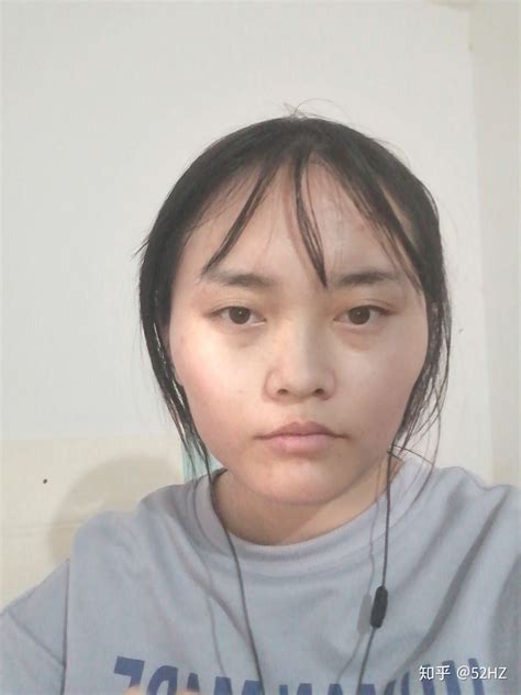 颧骨外扩脸方鼻子塌额头高真的没救了吗变美变美我要变美 知乎