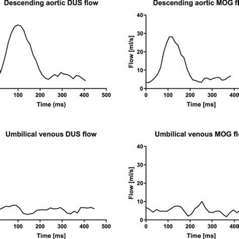 Typical Flow Curves For The Fetal Descending Aorta And Umbilical Vein