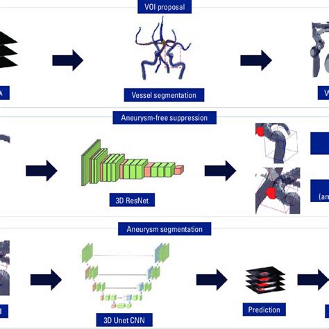Pipeline Of The Model A After Automated Vessel Segmentation And 3d