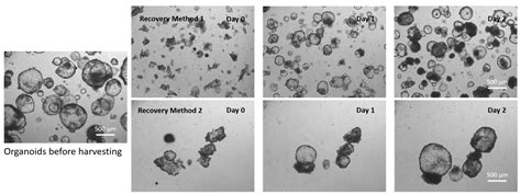 Organoid Harvesting From Matrigel Method Comparison Vitrogel Thewell