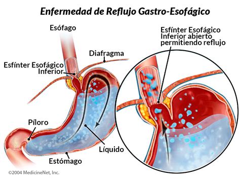 Fisiopatología Fisiopatología De Erge