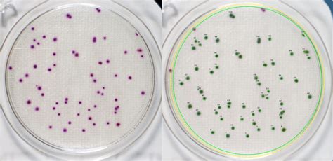 How To Count Bacterial Colonies On Agar Plate