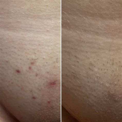 Before And After Using Bushbalm Skincare