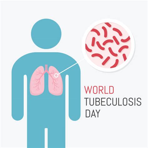 Best Tuberculosis Illustrations Royalty Free Vector Graphics And Clip