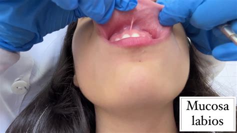 Mouth Exploration Thisvid Com