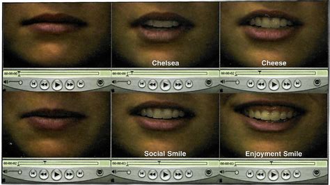 Performing Smile Analysis And Design With Digital Technology