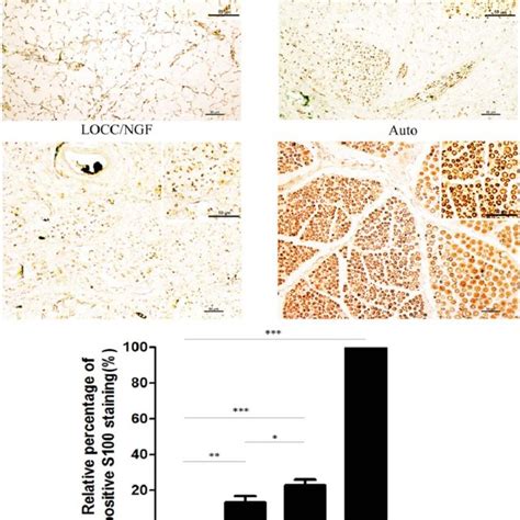 Representative Pictures Of The Immunohistochemistry Of Nf Staining At