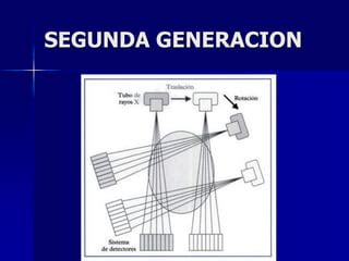 Partes Funicionamiento Y Generaciones De Un Tomografo Pdf