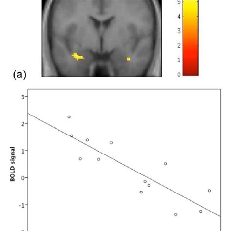 A Statistical Parametric Map Showing A Negative Correlation Between Download Scientific