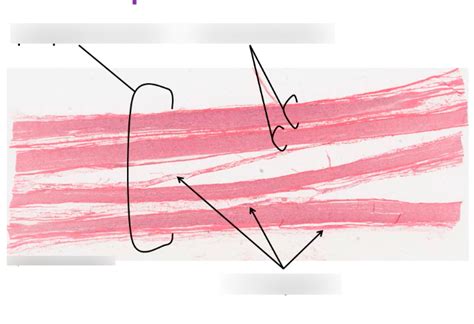 Example Of Sciatic Nerve Diagram Quizlet Example Of Sciatic Nerve Diagram Quizlet