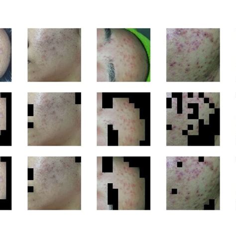 The Results Of Skin Detection By Binary Classifiersec 32 The First Download Scientific