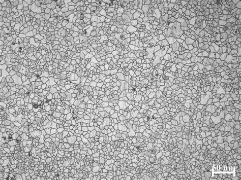 Microstructure Of Magnesium Alloy Metallurgical Engineering