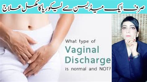What Is The Best Medicine For White Discharge White Discharge