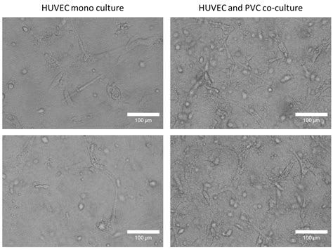 Huvec Cell Culture Media Shop Deals Gbu