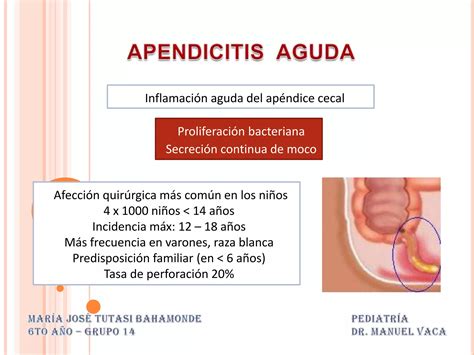 Apendicitis Aguda Pptx