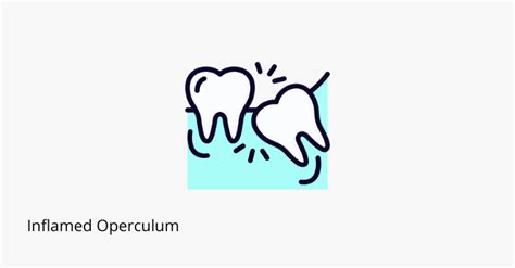 Inflamed Operculum Share Dental Care