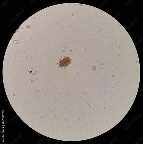 Hookworm Eggs Under Microscope