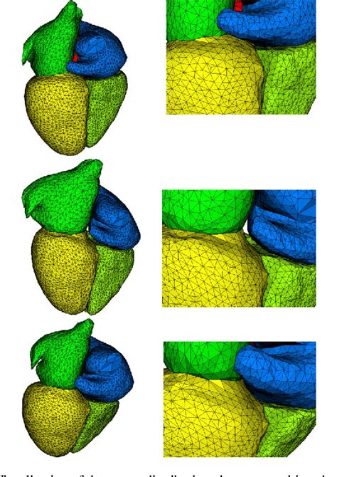 Figure 3 From Automatic Model Based Segmentation Of The Heart In Ct