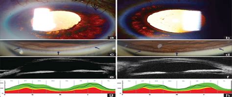 Middle East African Journal Of Ophthalmology