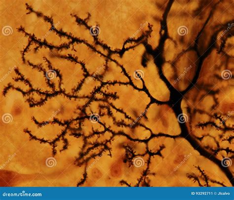 Purkinje Neuron Dendritic Tree Stock Image Image Of Tissue Microscopy 93292711