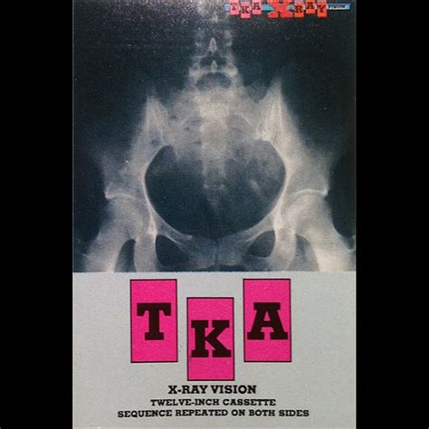 X Ray Vision Tka
