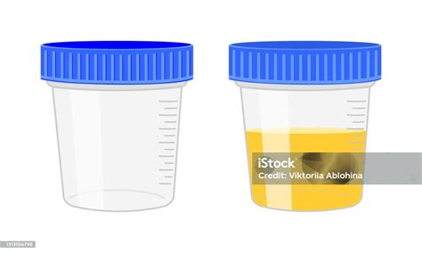 소변 소변 샘플 빈 전체 플라스틱 용기 실험실 검사 및 진단 개념 벡터 만화 일러스트레이션 컵에 대한 스톡 벡터 아트 및 기타 이미지 Istock