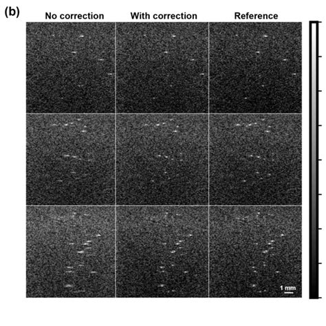 Phase Aberration Correction Performed On Simulated Microbubble Flows Download Scientific
