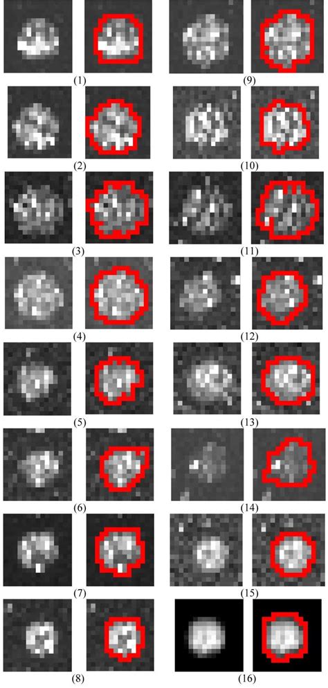 spot segmentation results of several magnified real microarray