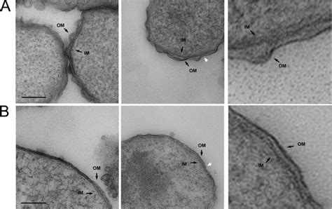 Transmission Electron Micrographs Of Ultrathin Sections From A Download Scientific Diagram