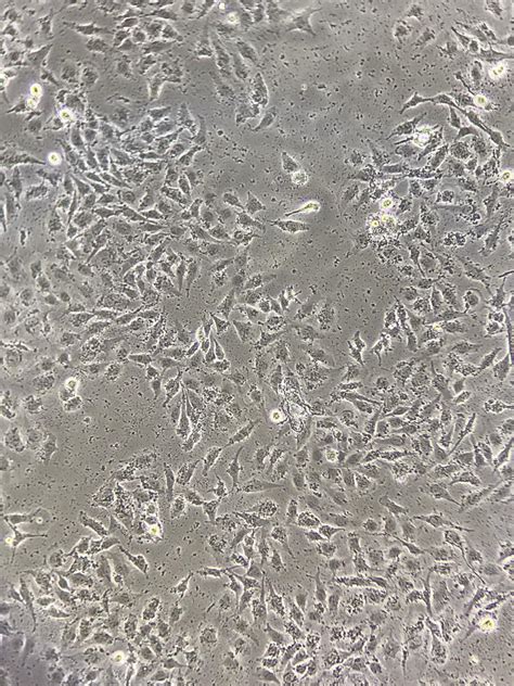 280 Questions With Answers In Turbidity Science Topic