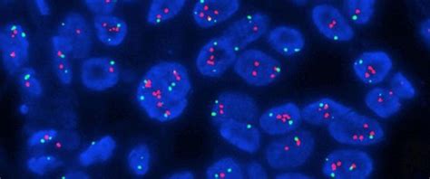 Molecular Genetic Pathology Fellowship Department Of Pathology