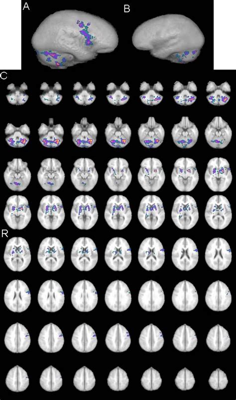 FMRI Female Group Analysis FMRI Map Activation Patterns In The Group Of Download Scientific