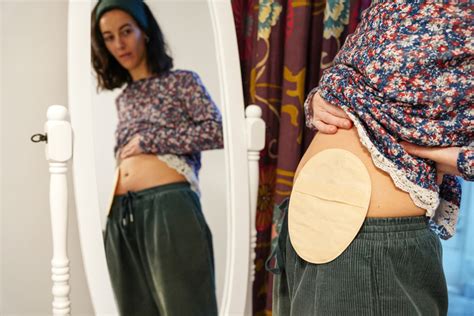 Slowing Down Ileostomy Output My Care Supplies