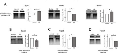 Figure 7 From The Short And Long Term Proteomic Effects Of Sleep