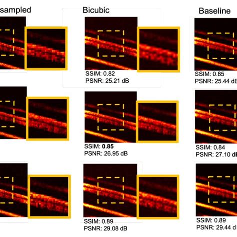 Representative Results Of Pae Edsr Enhancement Of Carbon Fibre