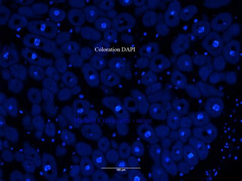 Site De Michèle Crevecoeur Coloration Au Dapi