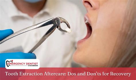 Tooth Extraction Aftercare Dos And Donts For Recovery