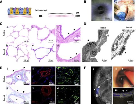 Human Lung Decellularization Extracellular Matrix Preservation And Download Scientific