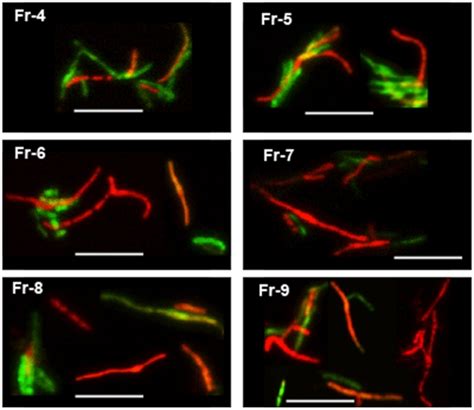Density Gradient Fractionation Was Performed As Described In Figure 5 Download Scientific