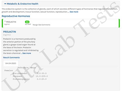 Prolactin Test Ulta Lab Tests