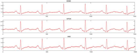 An Arrhythmia Classification Model Based On A Cnn Lstm Se Algorithm Pmc