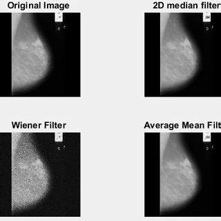 Noise Removal Using Filters Download Scientific Diagram