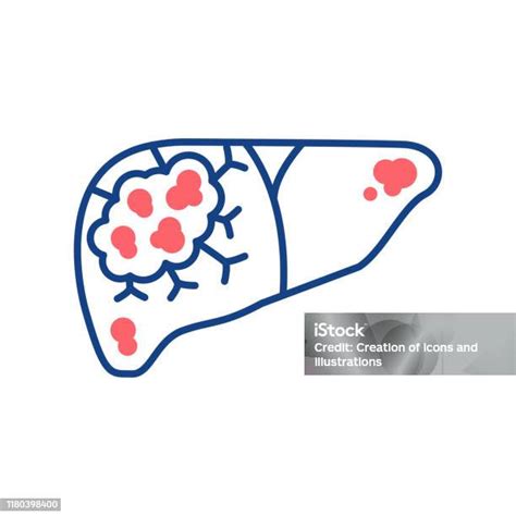 간암 선 색상 아이콘입니다 인간의 장기 개념 악성 신 생물 웹 페이지 모바일 앱 버튼 로고에 서명합니다 벡터 절연 요소 간 내부 기관에 대한 스톡 벡터 아트 및 기타 이미지