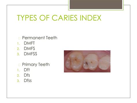Dmft Index Pptx